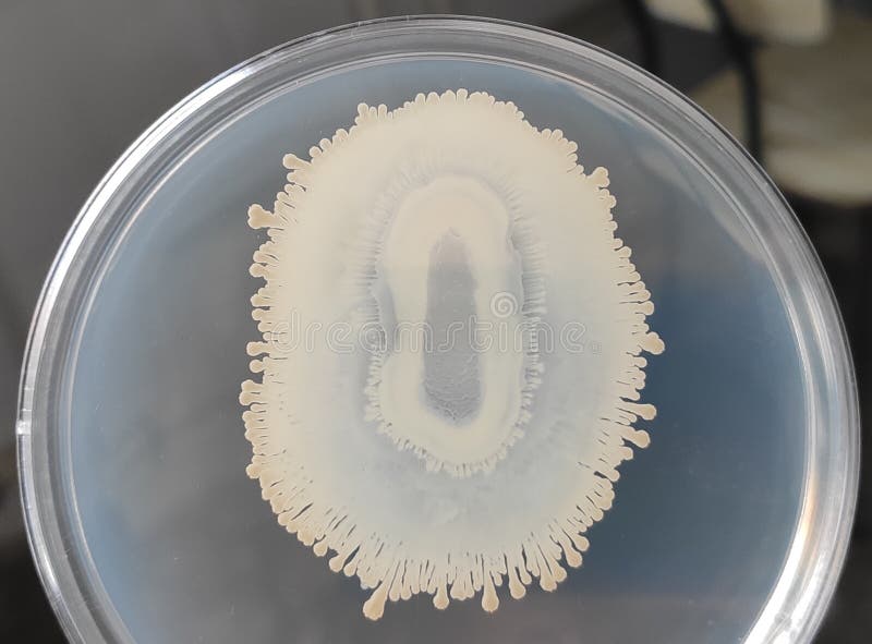 Bacillus Genus Bacteria Growing from a Sample Stock Image - Image of ...