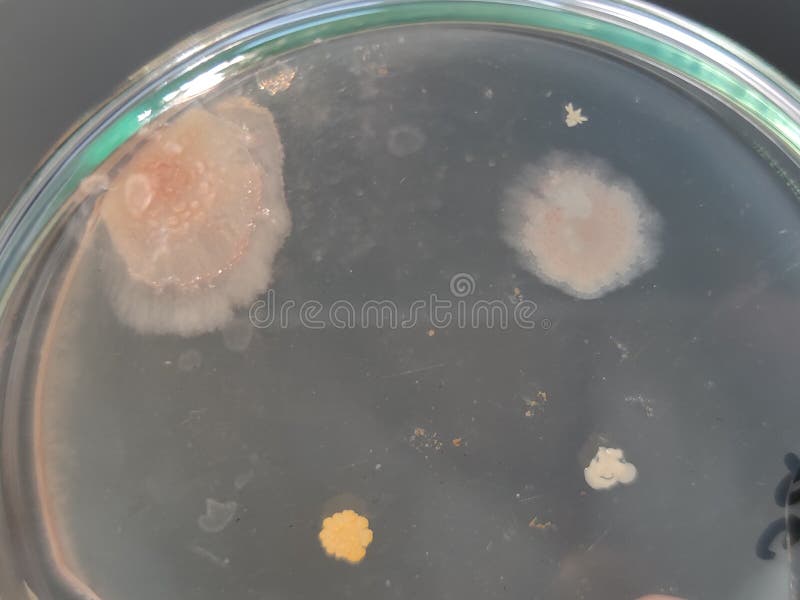 Bacillus Subtilis Colony On Blood Agar