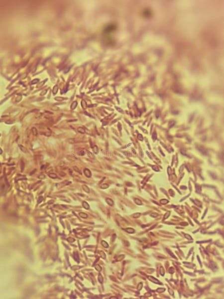 Bacillus Spore Forming Bacteria - Stained, Microscopic View Stock Photo ...