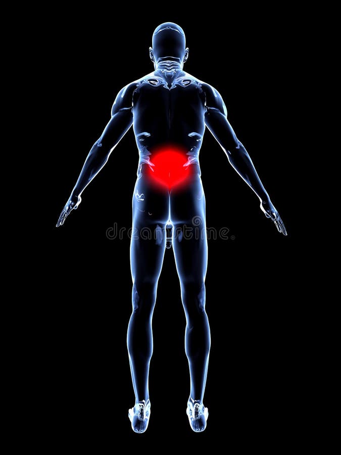 Human Body Joint Pain Inflamation Medical X-ray Stock Illustration ...