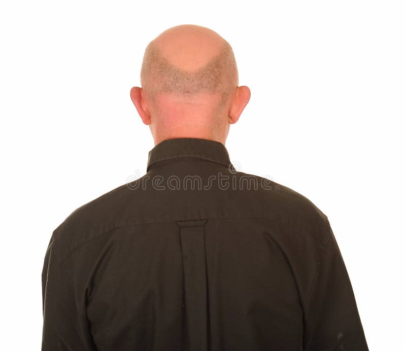 Bald Man Looking Up stock photo. Image of head, look, gaze - 4534430