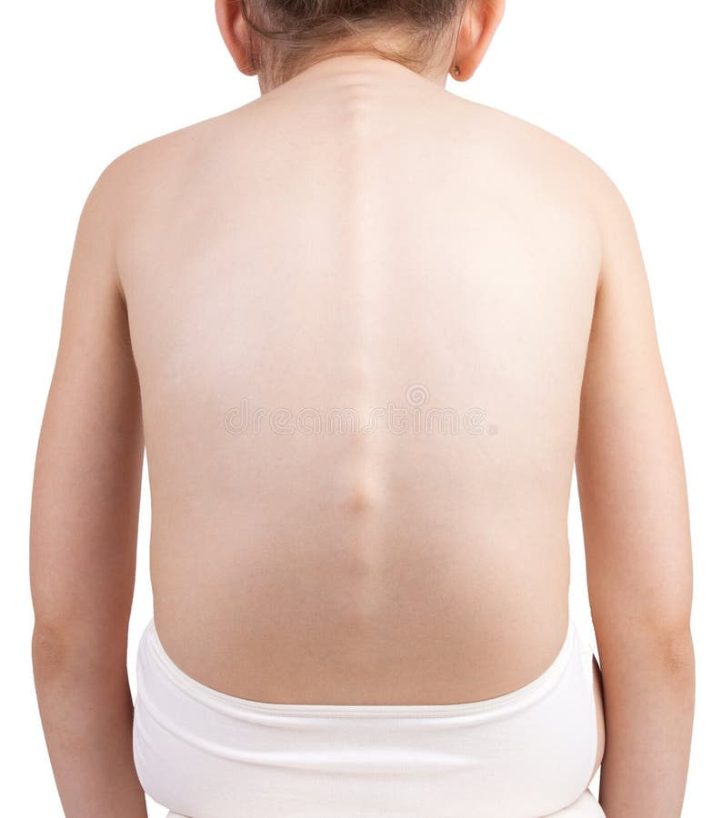 Back of the Child with a Spine Stock Photo - Image of people, back ...