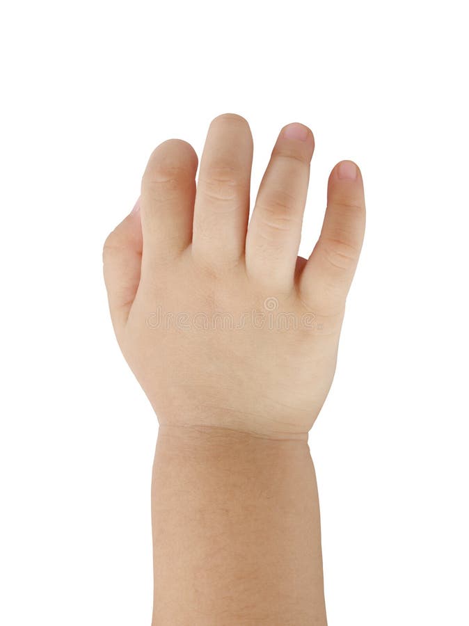 The Back of the Hand Was a Fresh Wound and Bleeding Caused by a Steel ...