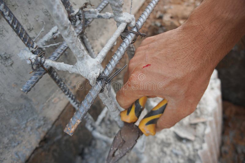 The Back of the Hand Was a Fresh Wound and Bleeding Caused by a Steel ...