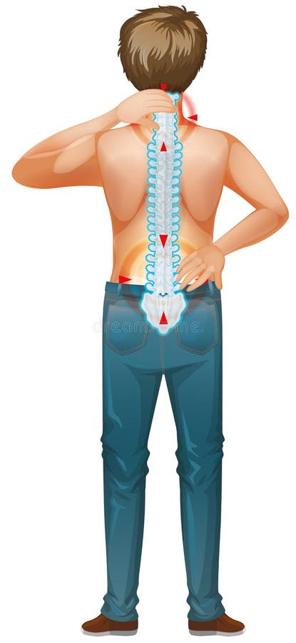 Cartoon Back Pain Stock Illustrations – 2,131 Cartoon Back Pain Stock ...