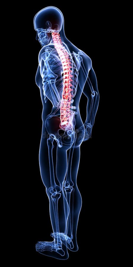 Back pain with full body stock illustration. Illustration of medicine ...