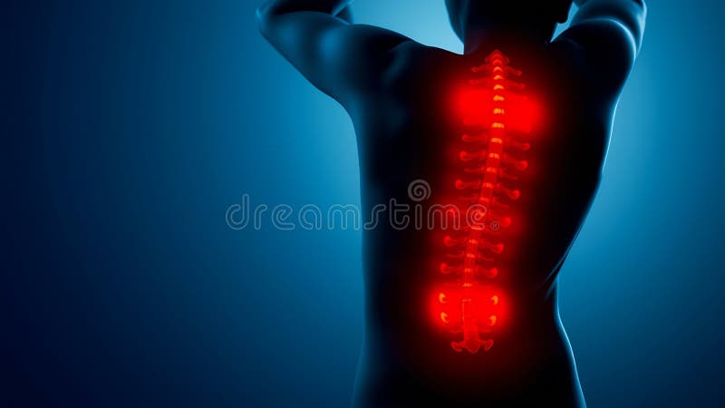 Back Pain Illustration with Red Glow Stock Illustration - Illustration ...