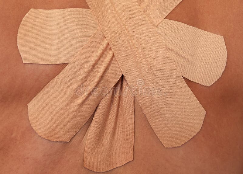 Back pain treatment stock photo. Image of healthy, muscle - 206199216