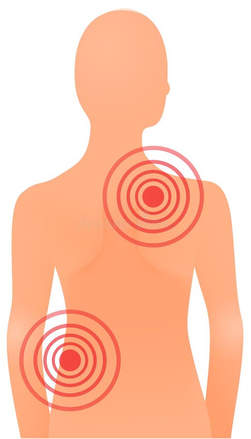 Back or Shoulder Pain Concept Stock Vector - Illustration of sore ...