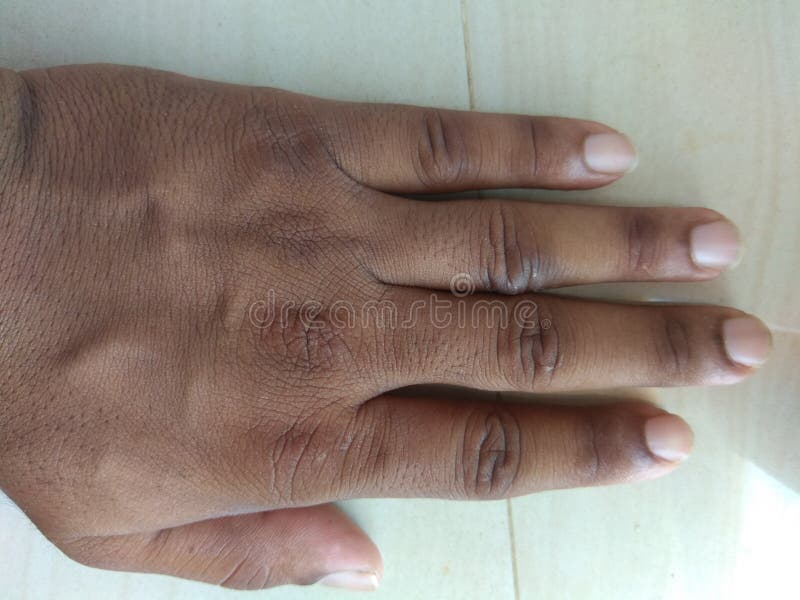 Back side of palm stock photo. Image of palm, back, blackish - 151944798