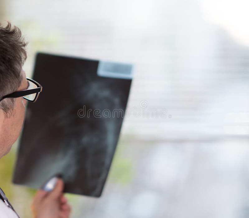 Doctor Reading X-ray Images Stock Image - Image of health, medical ...