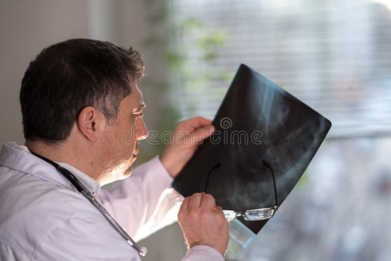 Doctor Reading X-ray Images Stock Photo - Image of illness, looking ...