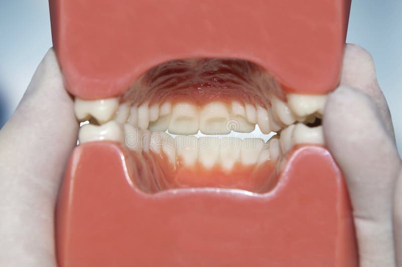 Back view of dental model stock photo. Image of oral - 69574106