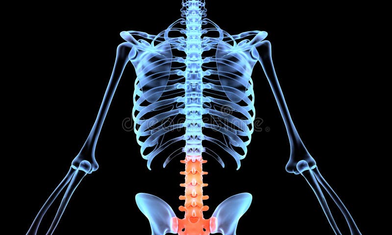 X-ray Lumbar Section of the Spine Back View with Injury Stock ...