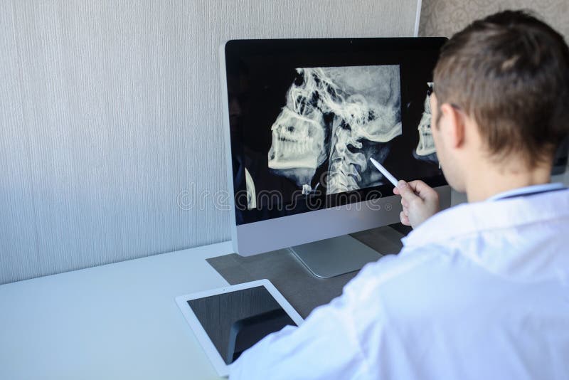 Back View of a Male Radiologist Examining Neck X-rays Cervical ...