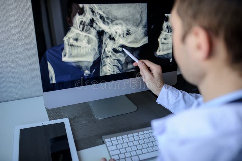 Lateral View of a Male Radiologist Examining a X-ray Stock Image ...