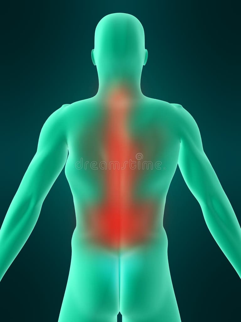 Backache Stock Illustrations – 11,068 Backache Stock Illustrations ...
