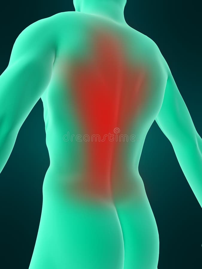 Backache stock illustration. Illustration of anatomical - 5564667
