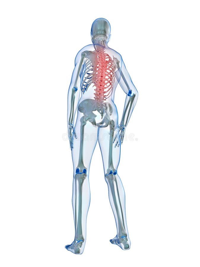 Backache stock illustration. Illustration of anatomical - 8689099