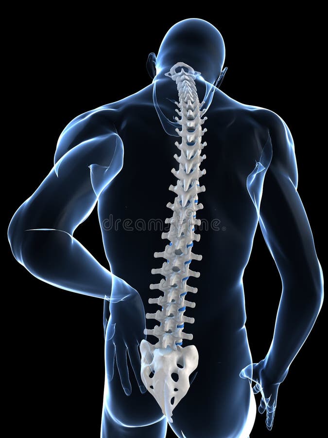 Backache stock illustration. Illustration of arthralgia - 8855967