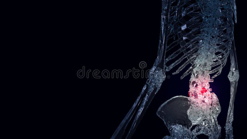 The Crystal Skelton for Backache Concept 3d Rendering Stock ...