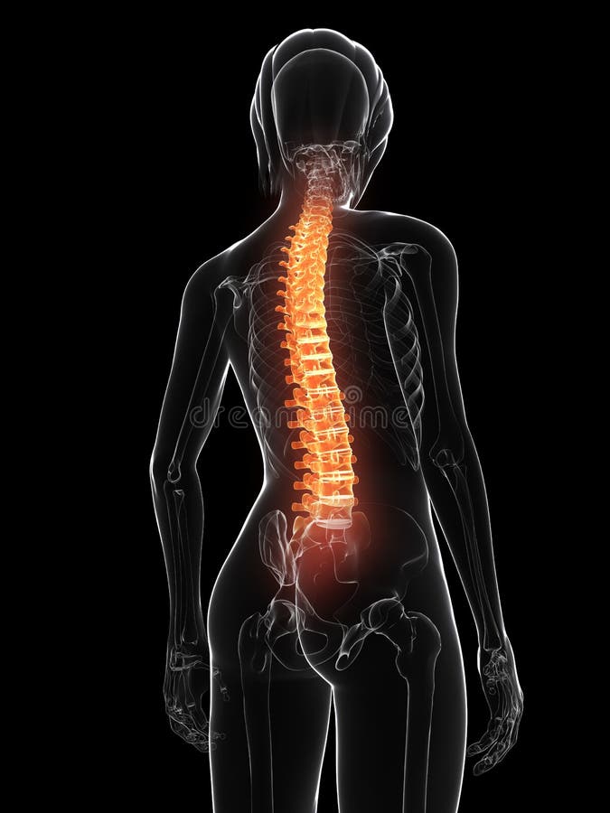Backache illustration stock illustration. Illustration of disc - 18583232
