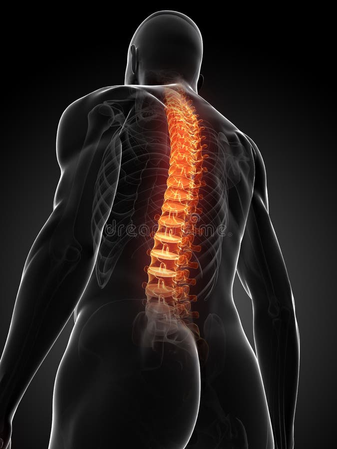 Backache illustration stock illustration. Illustration of inflammation ...