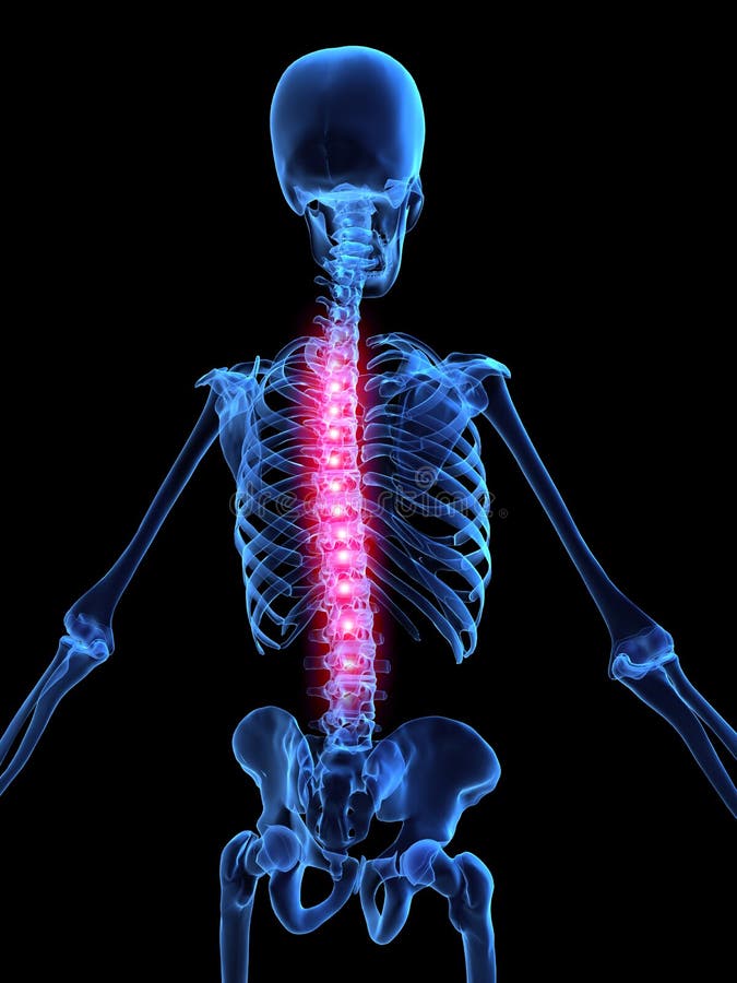 Backache stock illustration. Illustration of anatomical - 5564667
