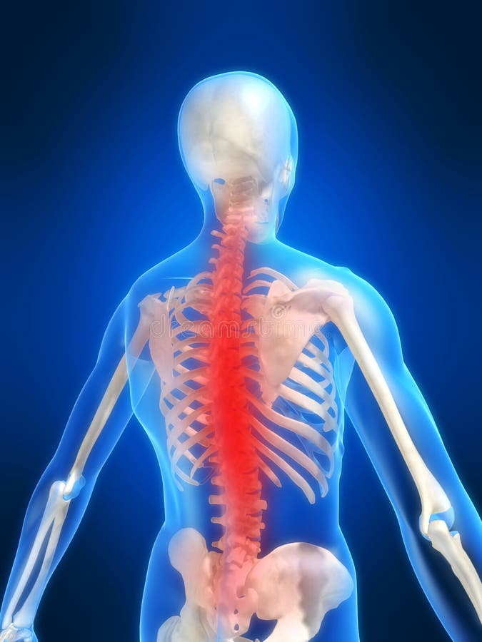 Backache Illustration Stock Illustrations – 8,697 Backache Illustration ...