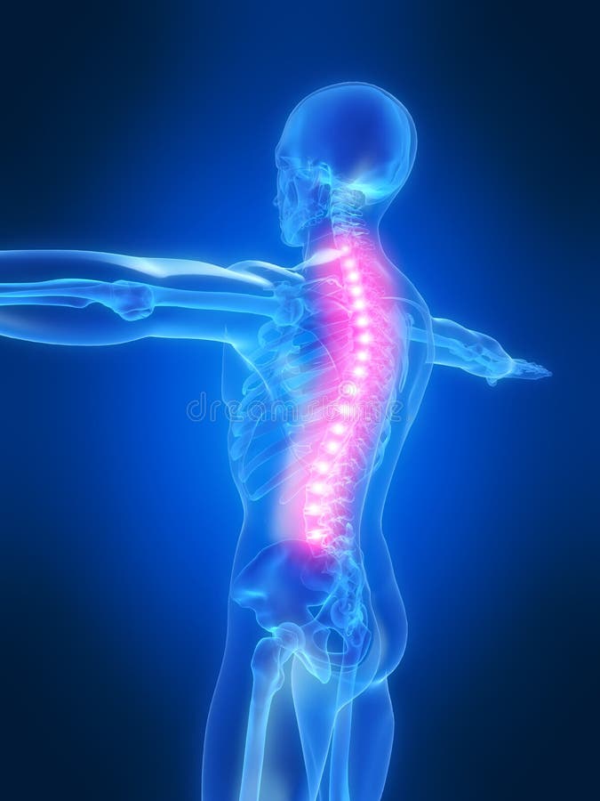 Backache illustration stock illustration. Illustration of bones - 2590033