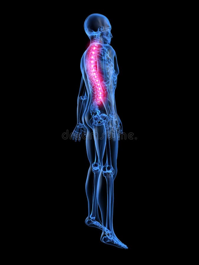 Backache illustration stock illustration. Illustration of backache ...