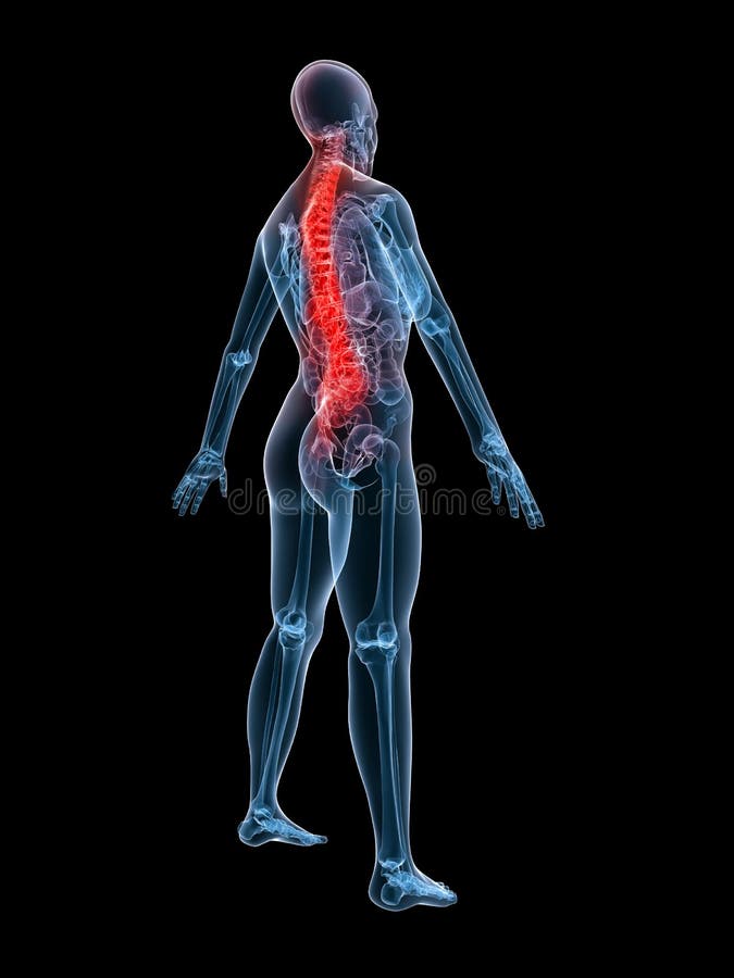 Backache illustration stock illustration. Illustration of health - 4129601