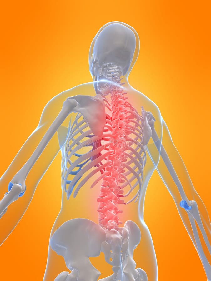 Backache illustration stock illustration. Illustration of joint - 4418321