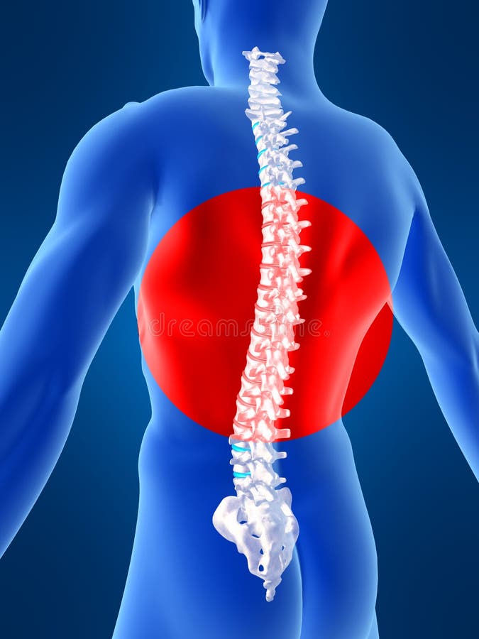 Backache illustration stock illustration. Illustration of bones - 4832471