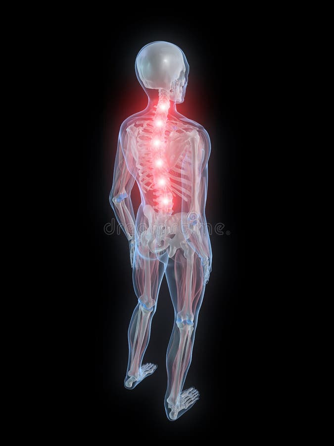 Backache illustration stock illustration. Illustration of blue - 7750504