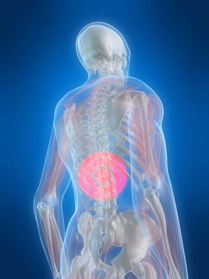 Backache illustration stock illustration. Illustration of bones - 7750569