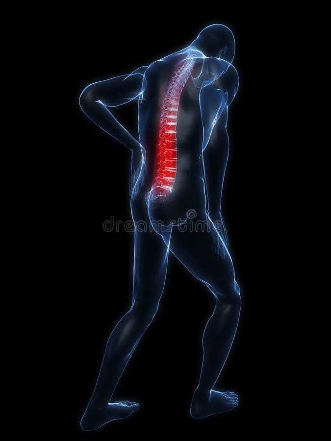 Backache illustration stock illustration. Illustration of medical - 8692186