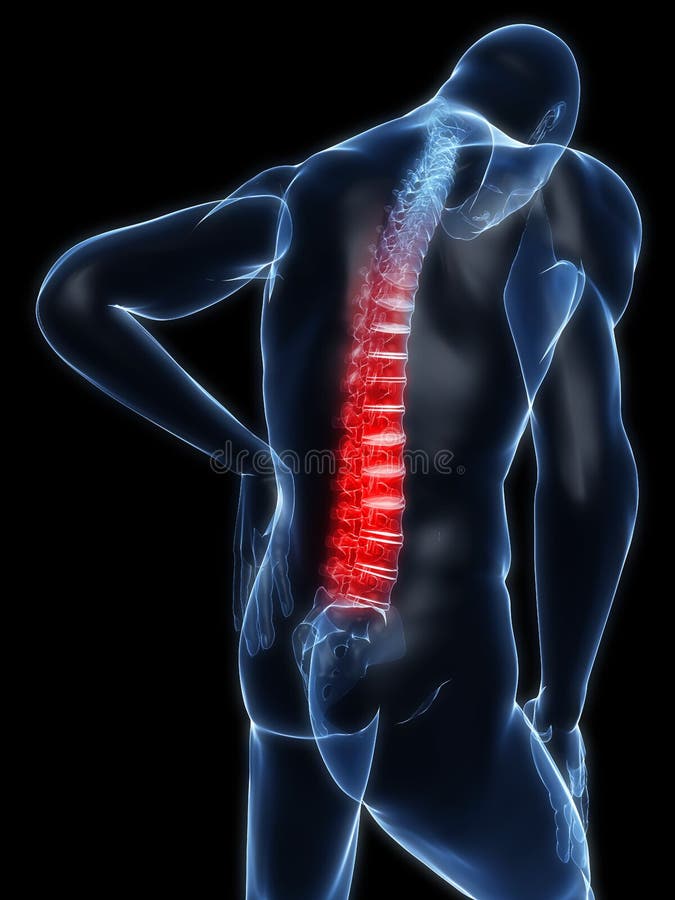 Backache illustration stock illustration. Illustration of rheumatism ...