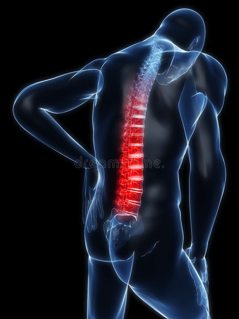 Backache Illustration Stock Illustrations – 9,098 Backache Illustration ...