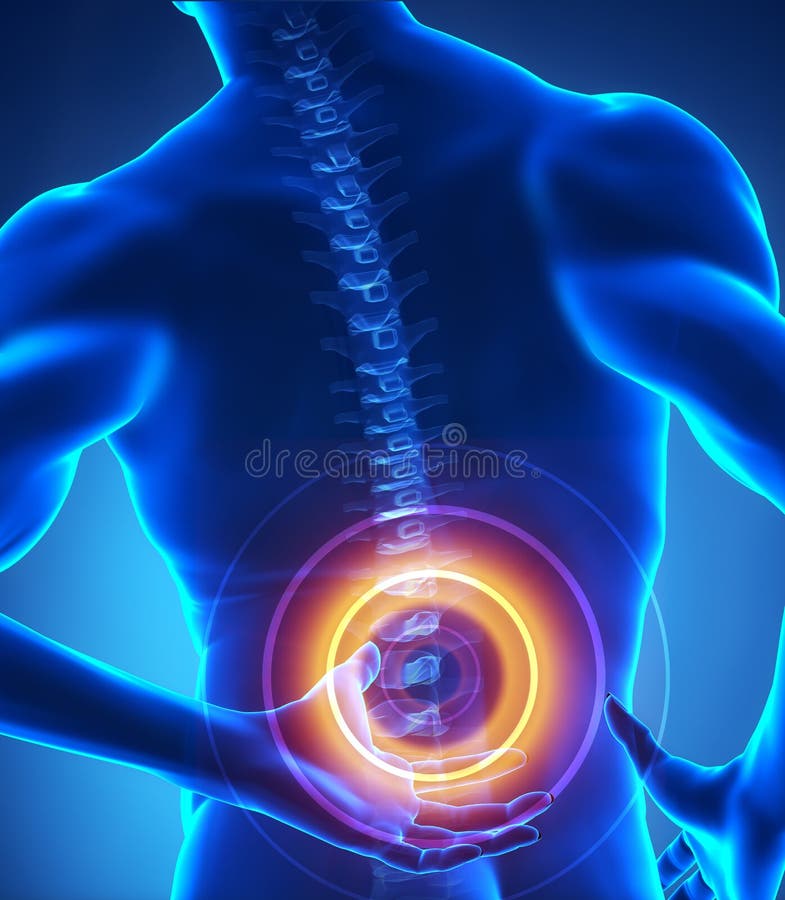 Backbone Problem X-ray View Stock Illustration - Illustration of ...