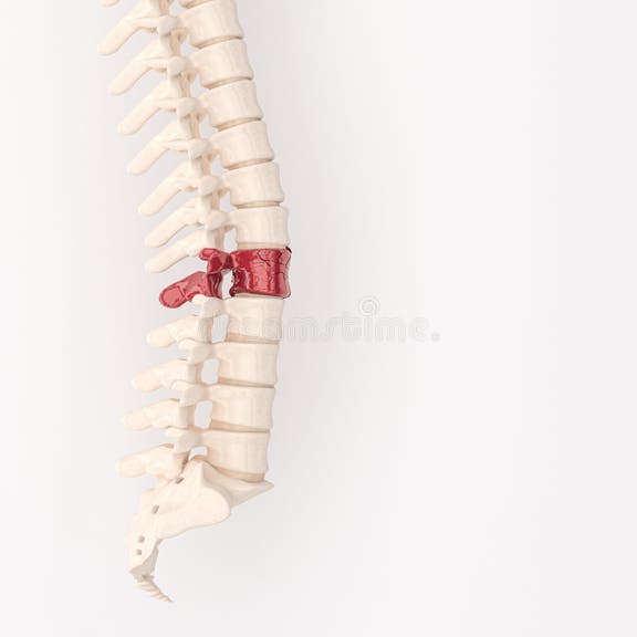 Backbone with Red Fragmented Vertebrae Stock Illustration ...