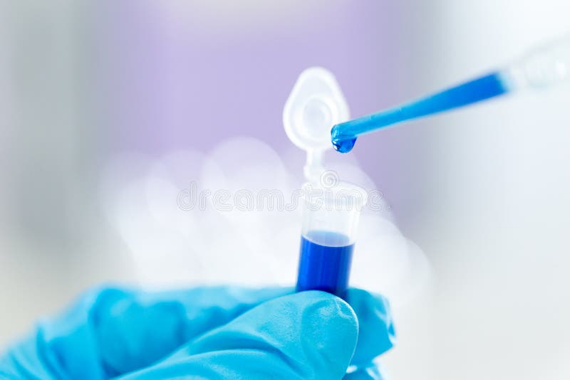 Biochemical Analysis and Chemical Analysis in Lab. Stock Photo - Image ...