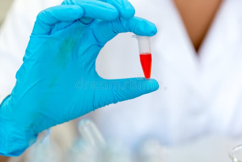 Biochemical Analysis and Chemical Analysis in Lab. Stock Image - Image ...
