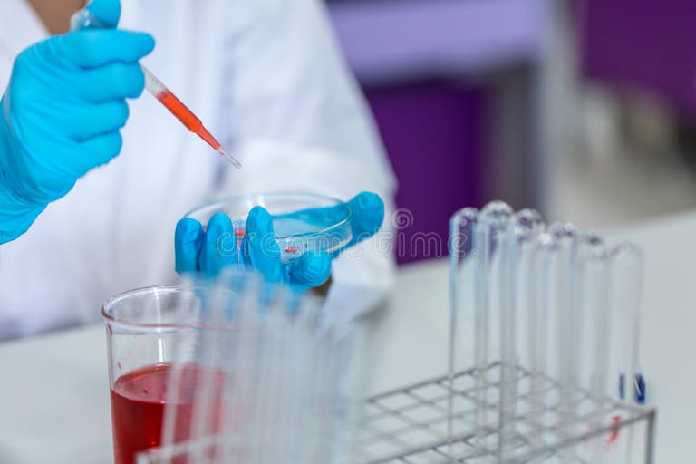 Biochemical Analysis and Chemical Analysis in Lab. Stock Image - Image ...