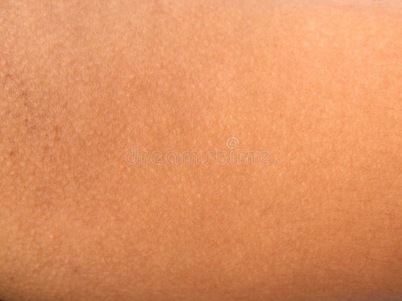 Background of the Human Skin Stock Image - Image of hairs, peel: 141767413
