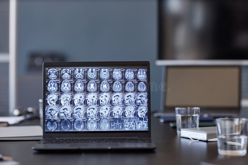 Pictures Of Open Mri Stock Photos - Free & Royalty-Free Stock Photos ...