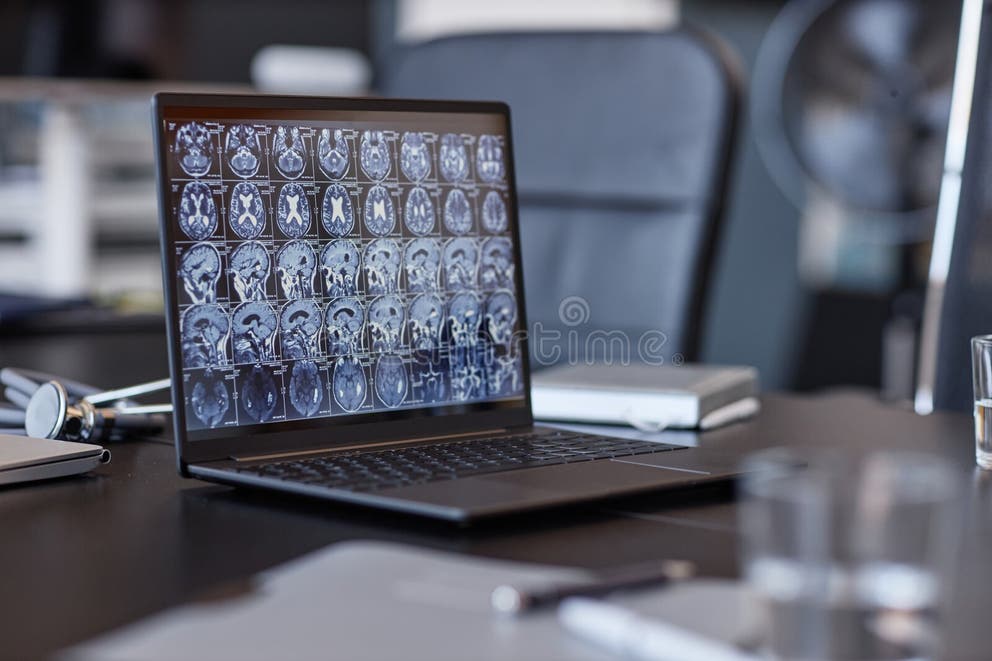 Open Laptop Showing X Ray Scan of Patients Brain on Meeting Table in ...