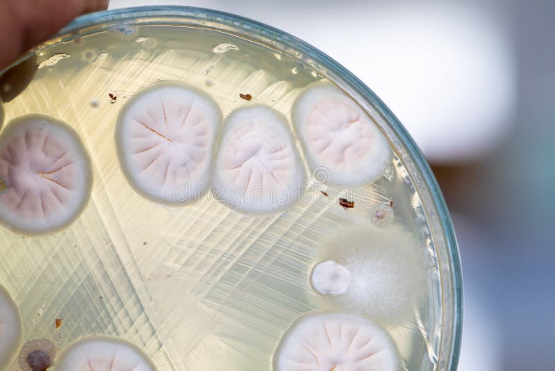 Backgrounds of Characteristics and Different Shaped Colony of Bacteria ...