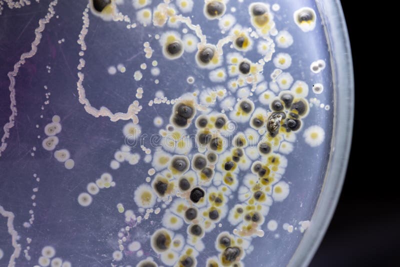 Characteristics and Different Shaped Colony of Bacteria and Mold ...