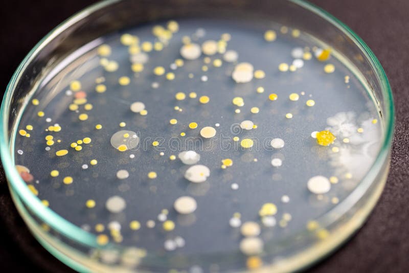 Characteristics and Different Shaped Colony of Bacteria and Mold ...